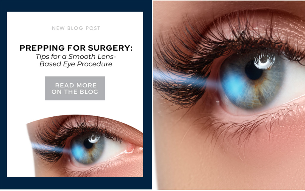 Prepping for Surgery: Tips for a Smooth Lens-Based Procedure | SightTrust